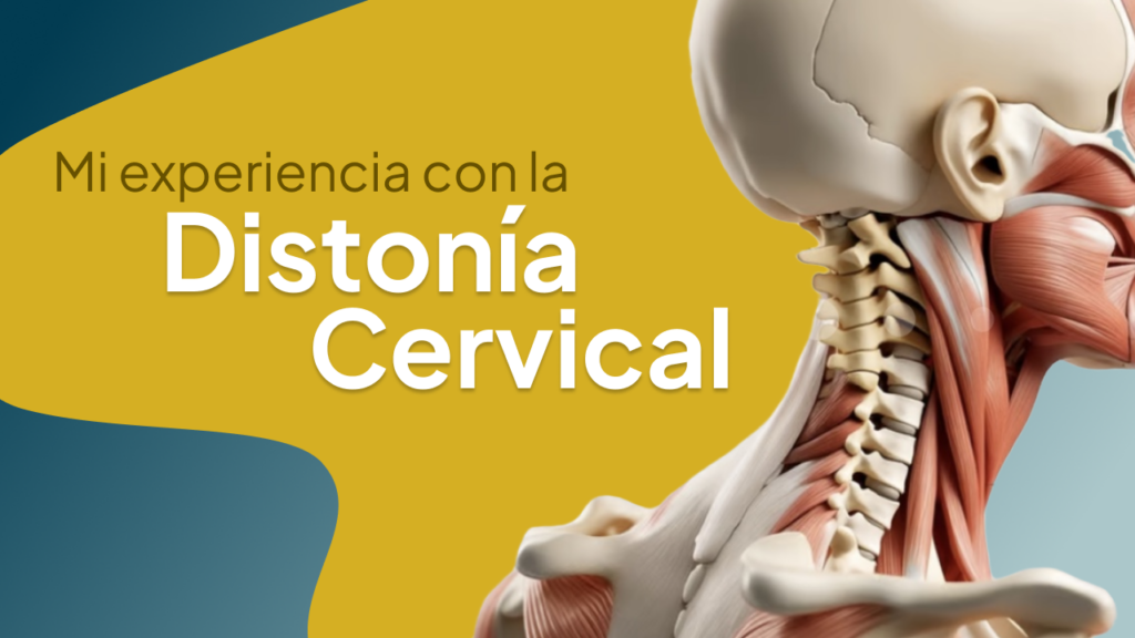 Mi Vuelta al Trabajo Después de la Distonía Cervical: Una Nueva Etapa ...